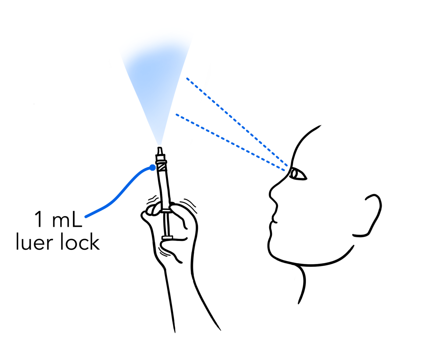 Successful usability study with Nasal Atomiser adapter • Medspray